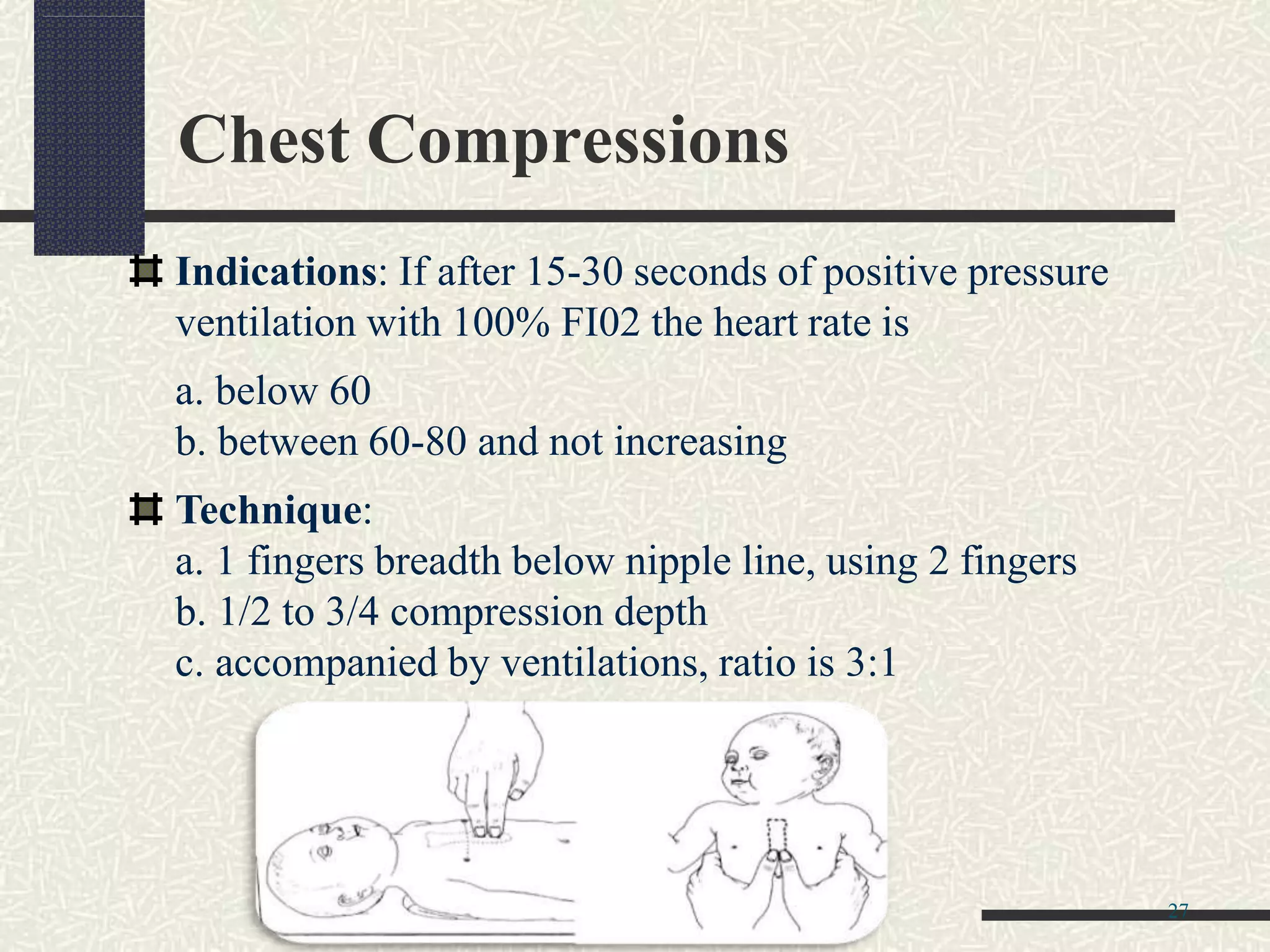 Neonate life support Resuscitation | PPTX