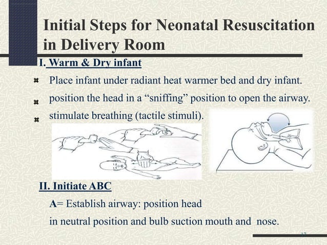 Neonate life support Resuscitation | PPTX