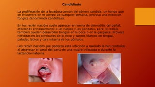 Neonatologia, neonato, enfermedades: anomalías congénitas e infecciones ...