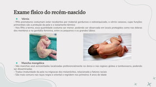 Introdução a Neonatologia (Exame Físico ) | PDF