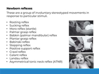Neonatology, birth asphyxia, APGAR in chilD | PPT