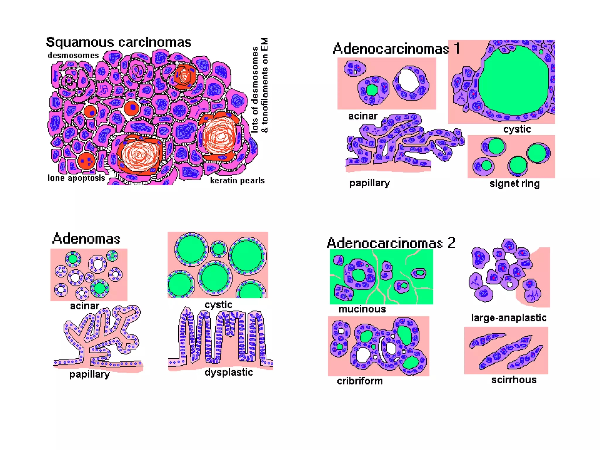 Neoplasia Characteristics and classification of cancer | PPTX
