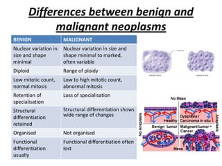 Benign Tumor Vs Malignant