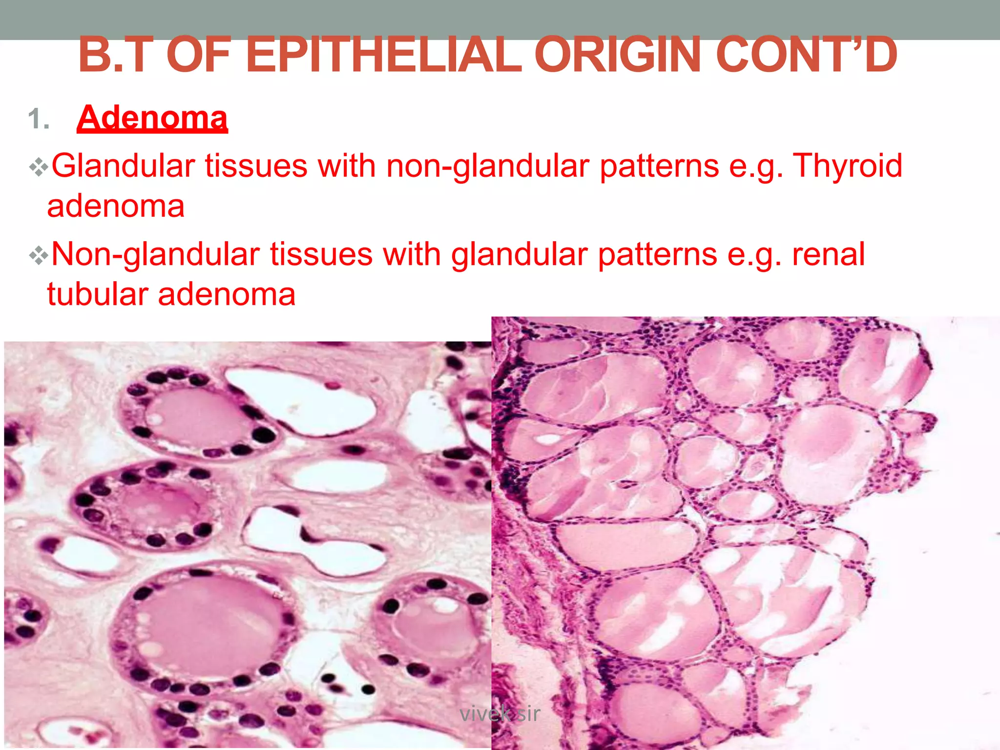 neoplasia pathology nursing .pptx
