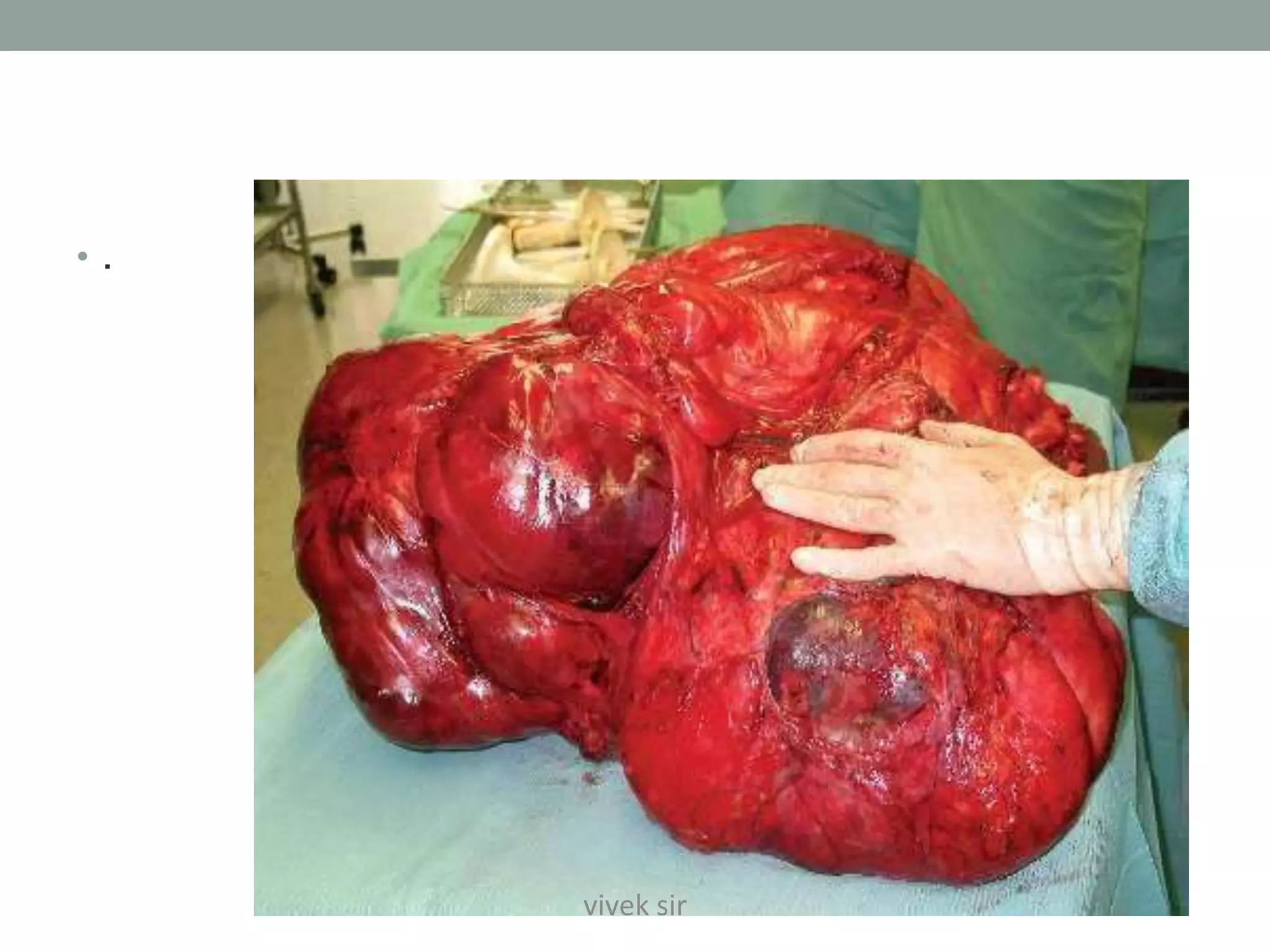 neoplasia pathology nursing .pptx