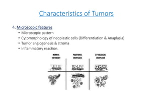 Neoplasia - Characteristics & Classification of Neoplasm | PPTX