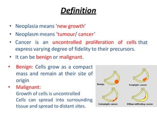 neoplasia.pptx