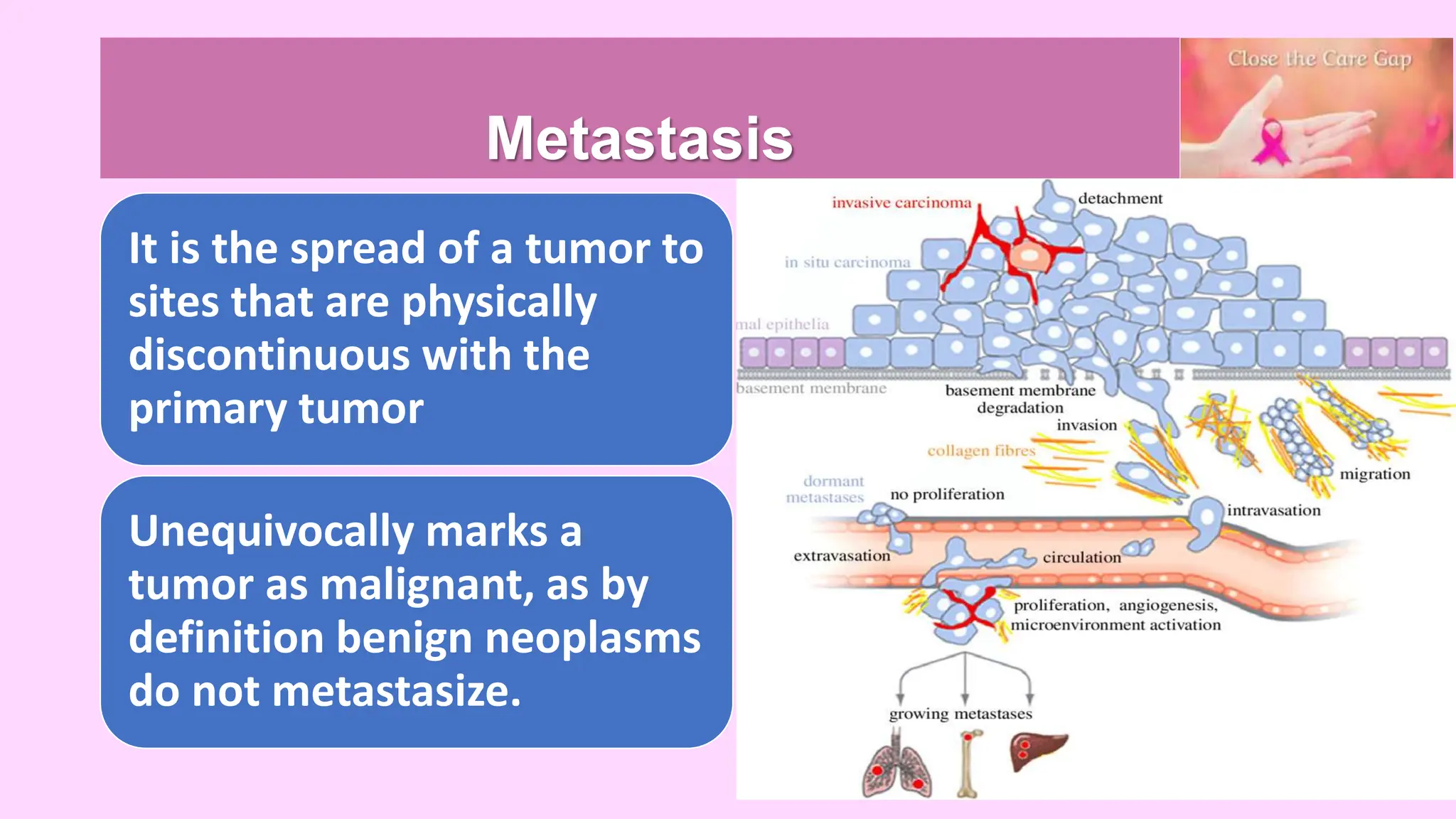 ANNOTATION ON THE BASIC CONCEPT OF NEOPLASM..PPTX