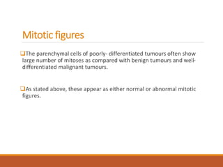 NEOPLASIA, cancer, Benign and malignant tumor | PPTX