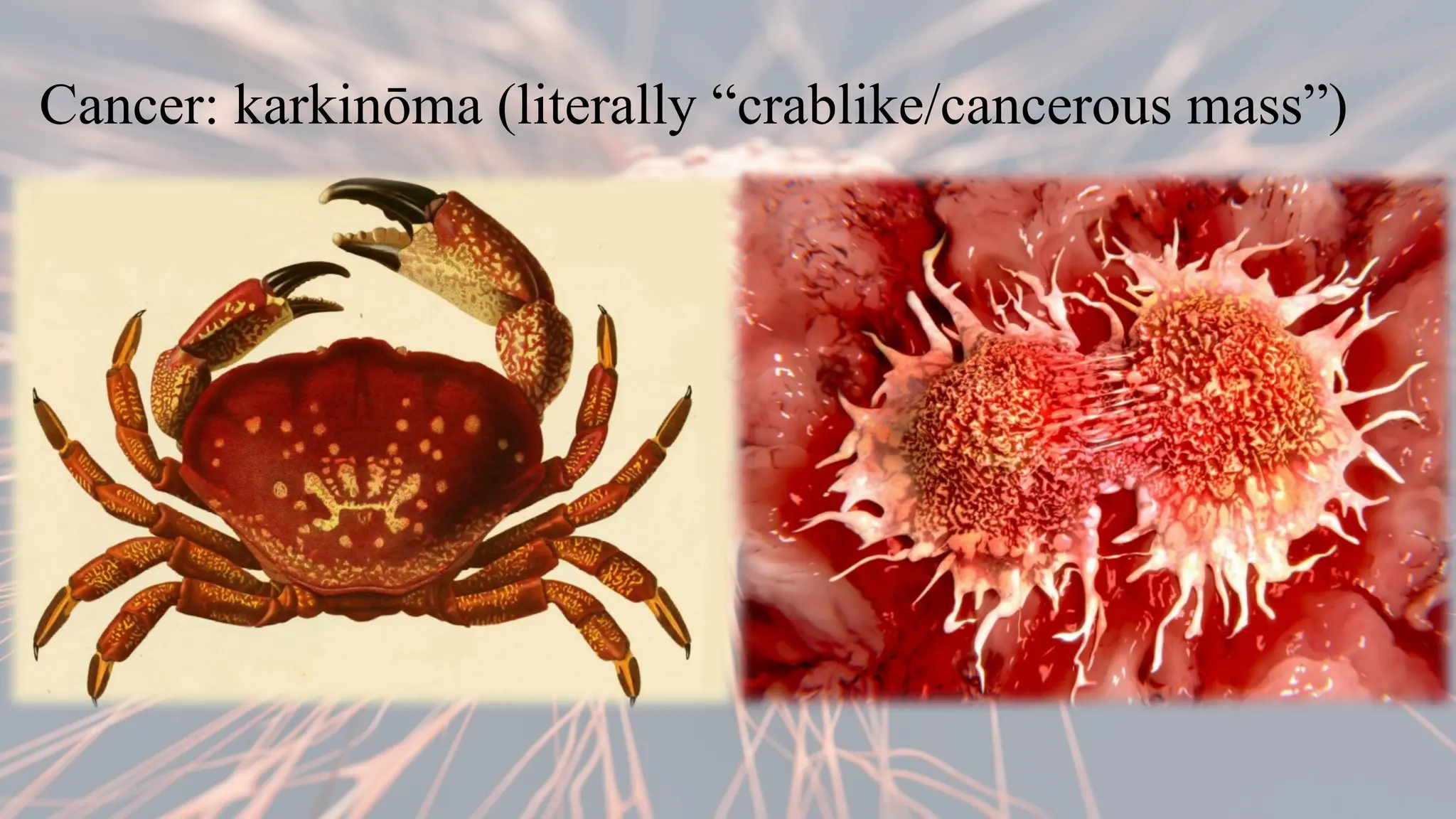 Neoplasia.pptxand disorder of body ceell | PPTX