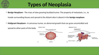 Neoplasia- Types, differences, and Methods of diagnosis. | PPTX