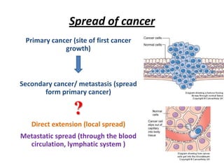 Neoplasia Clincial effects and Spread of cancer | PPTX