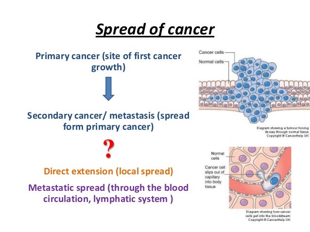 Neoplasia Clincial effects and Spread of cancer