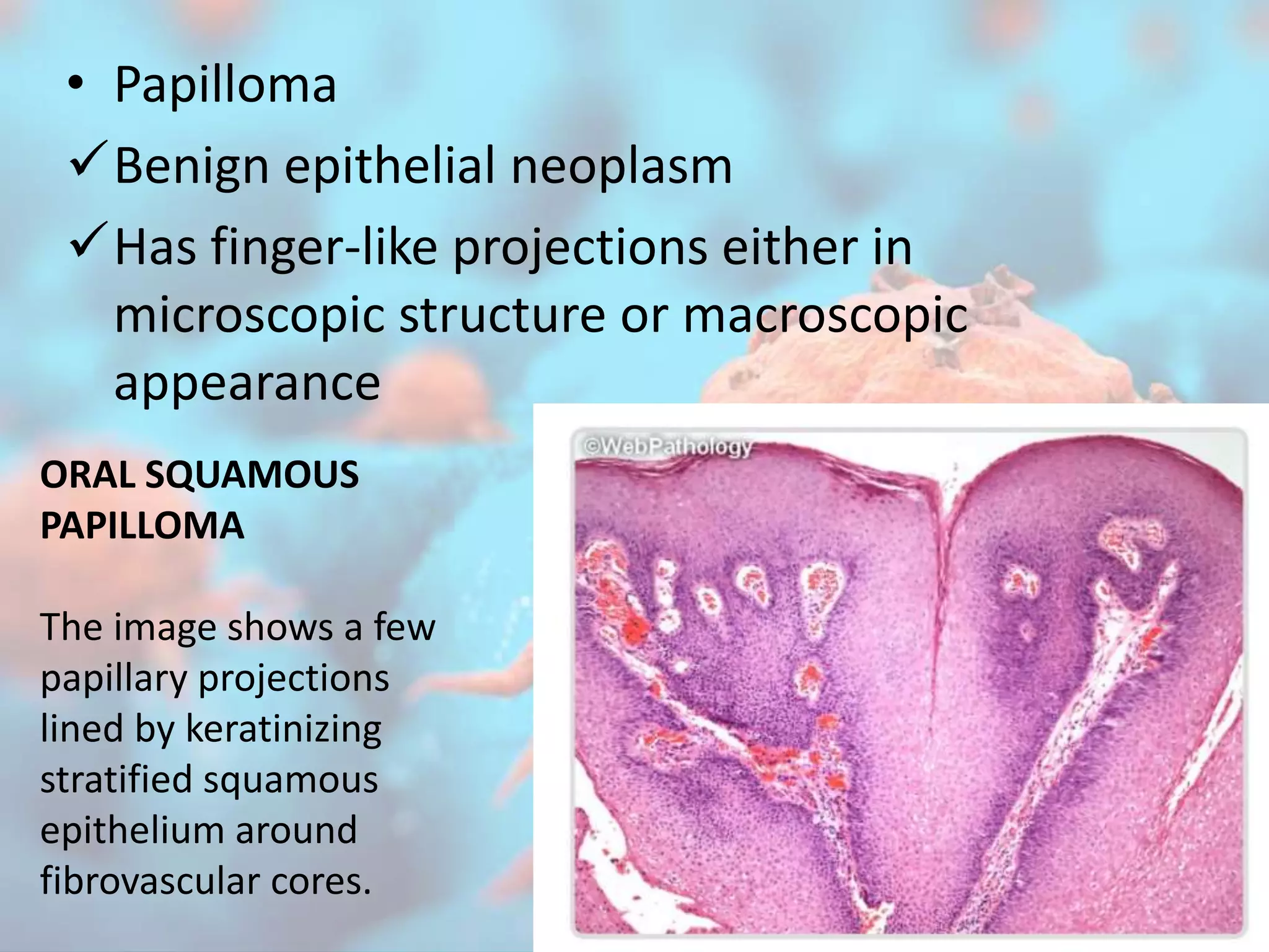 MBBS 2nd Year Pathology - Neoplasia : Introduction | PPTX