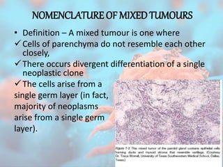 MBBS 2nd Year Pathology - Neoplasia : Introduction | PPTX