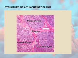 MBBS 2nd Year Pathology - Neoplasia : Introduction | PPTX