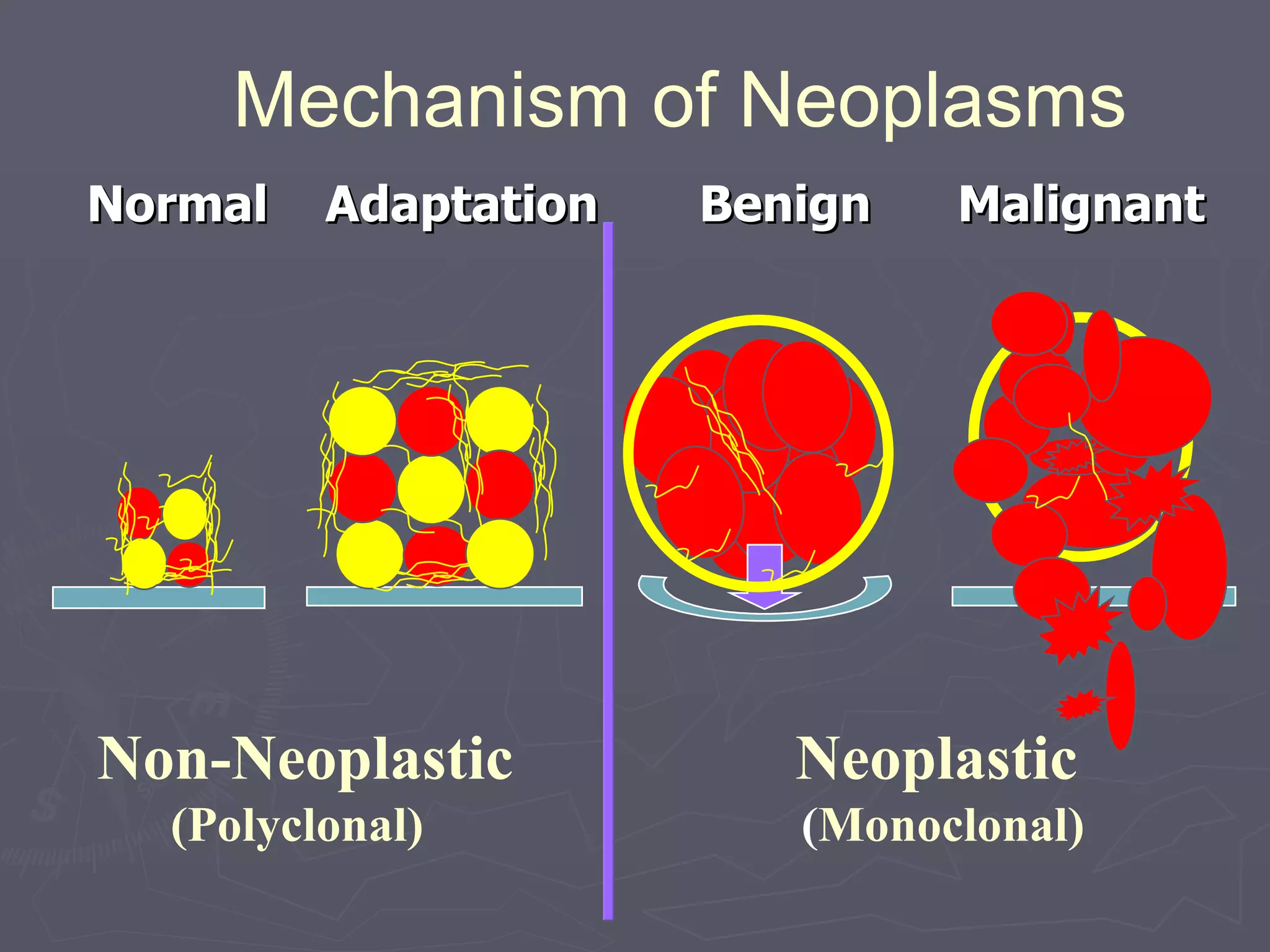 Neoplasia OSPE revisions! | PPT