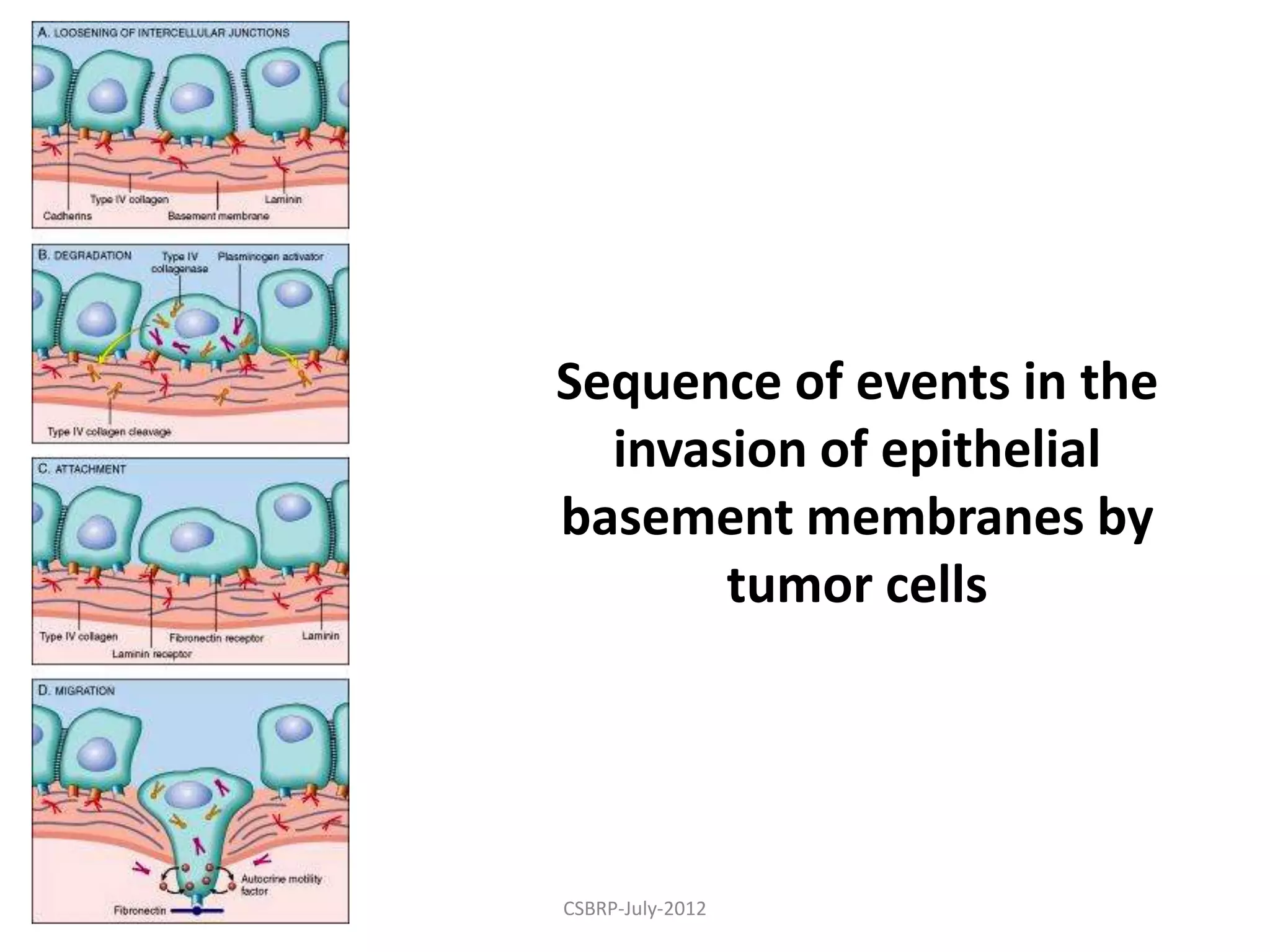 Neoplasia Robbin's path | PPTX