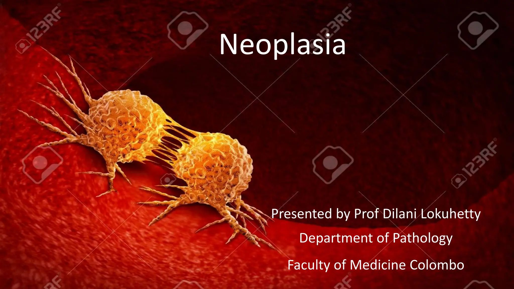Neoplasia - Benign and malignant tumours nomenclature and difference.pdf