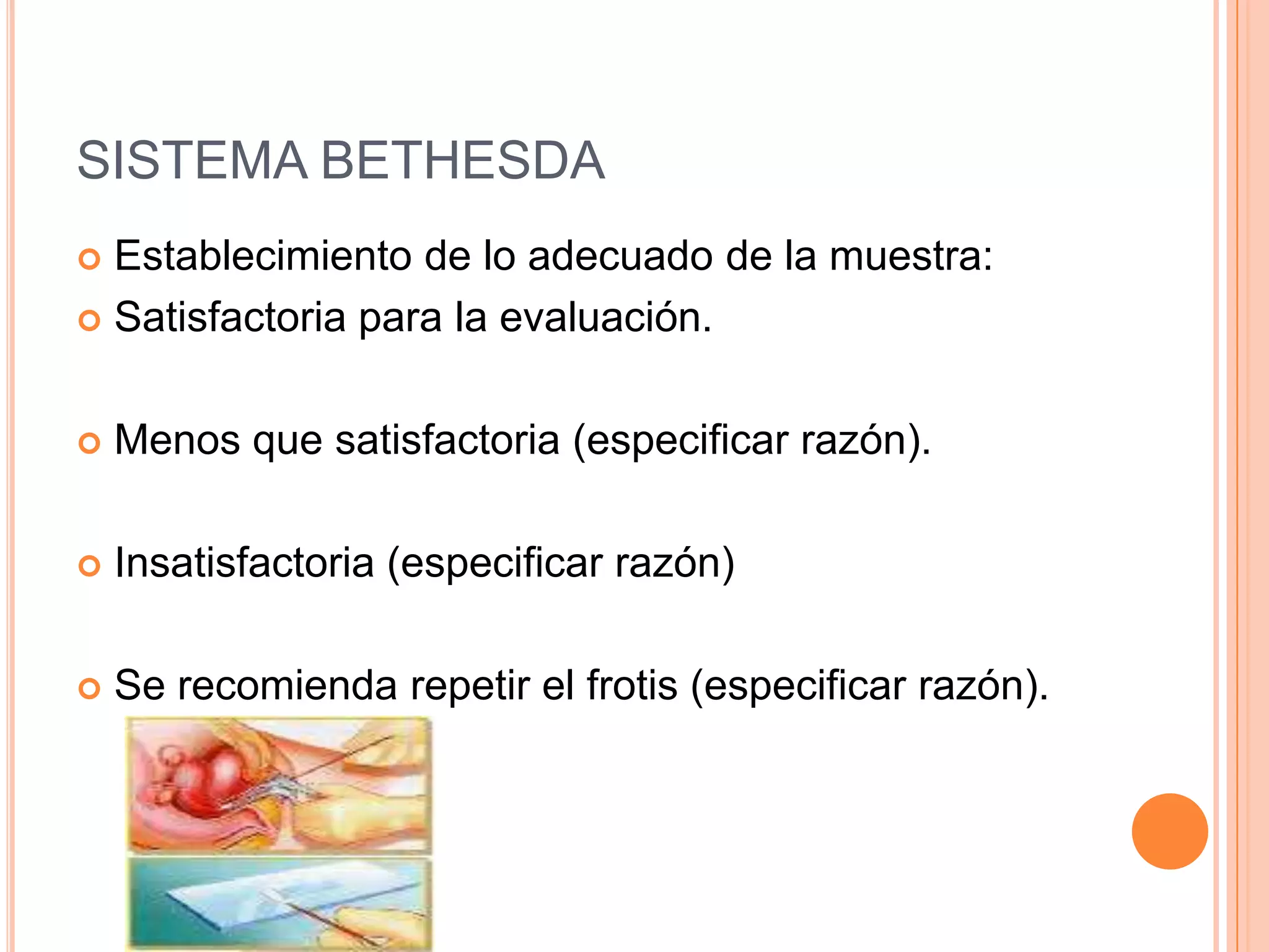 Neoplasia intraepitelial cervical (leibg y leiag) | PPTX