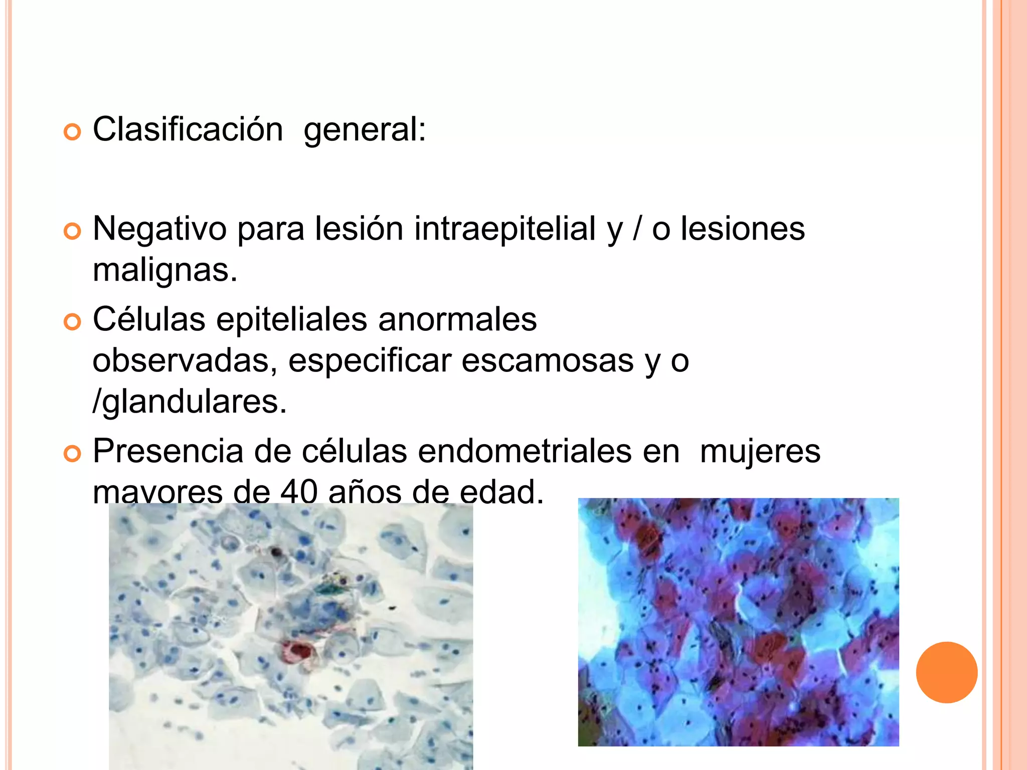 Neoplasia intraepitelial cervical (leibg y leiag) | PPTX