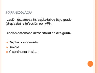 Neoplasia intraepitelial cervical (leibg y leiag) | PPTX