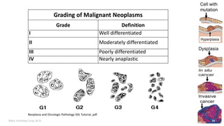 Neoplasia & Oncologic Pathology | PDF
