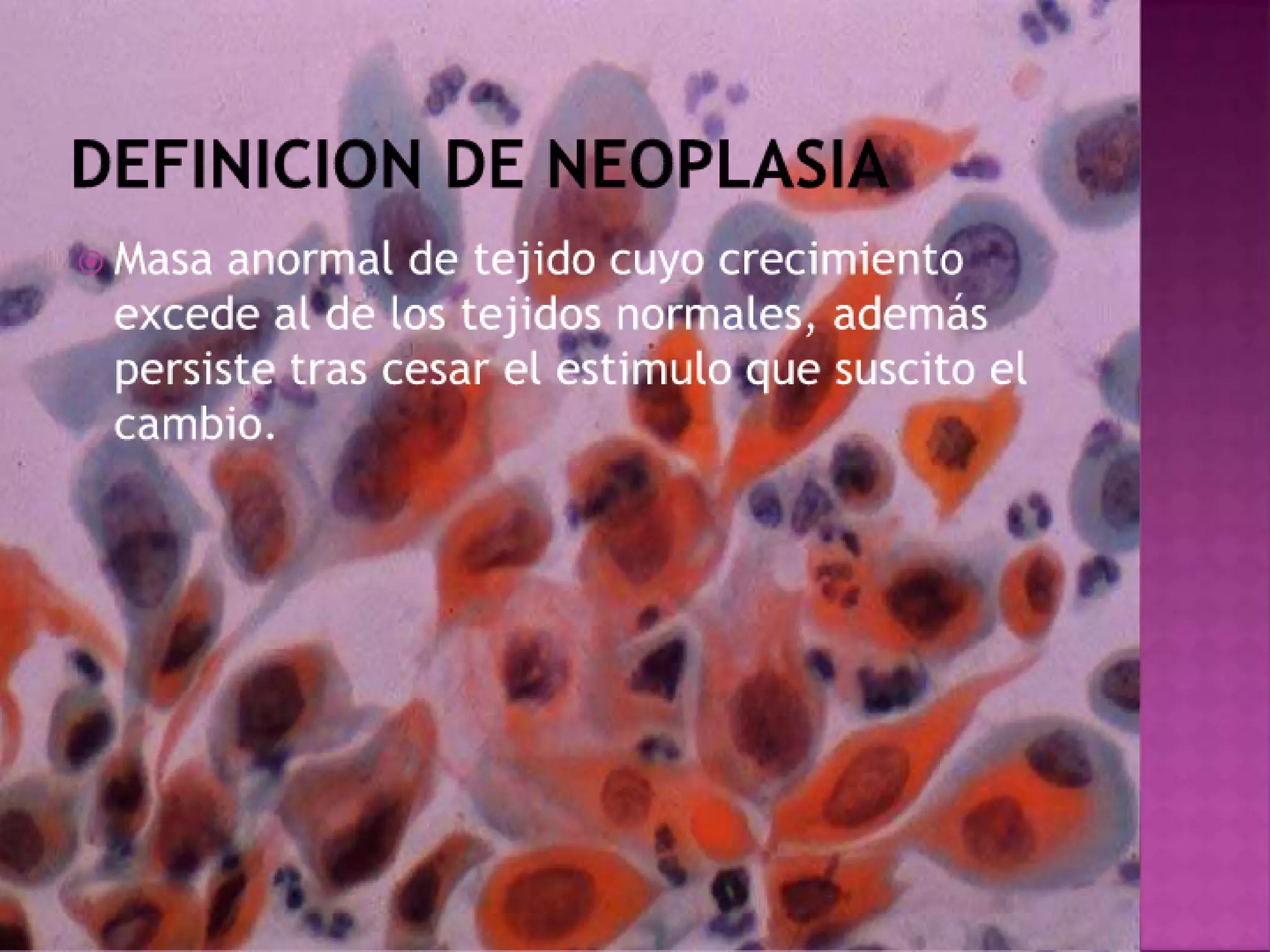 Neoplasias | PPT