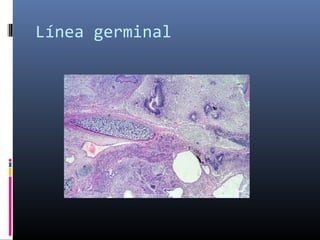 Neoplasias | PPT