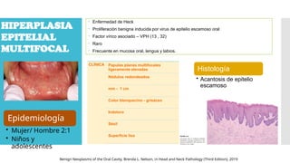 NEOPLASIAS BENIGNAS DE LA CAVIDAD ORAL.pptx