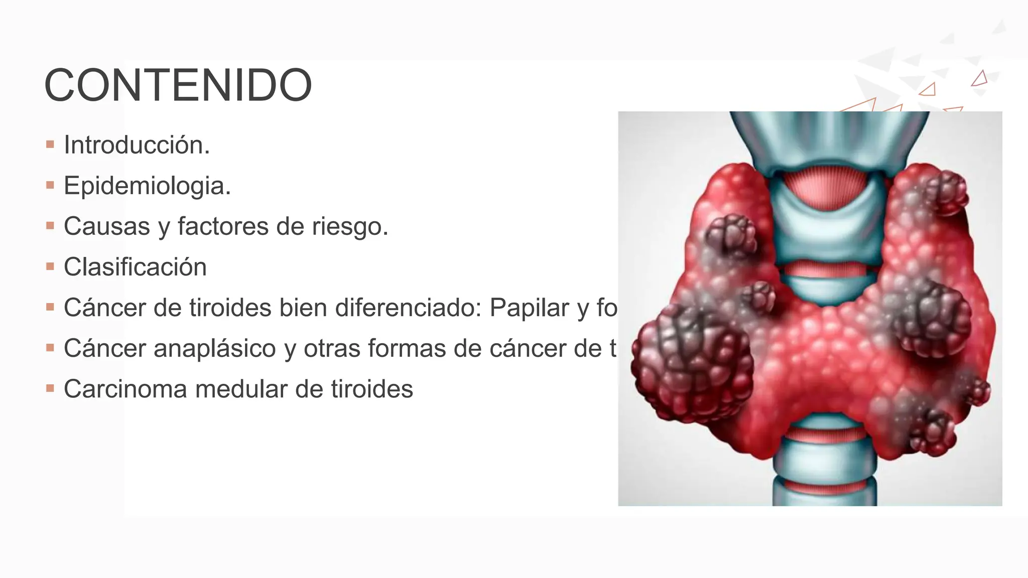 NEOPLASIAS MALIGNAS DE TIROIDES terminado.pptx