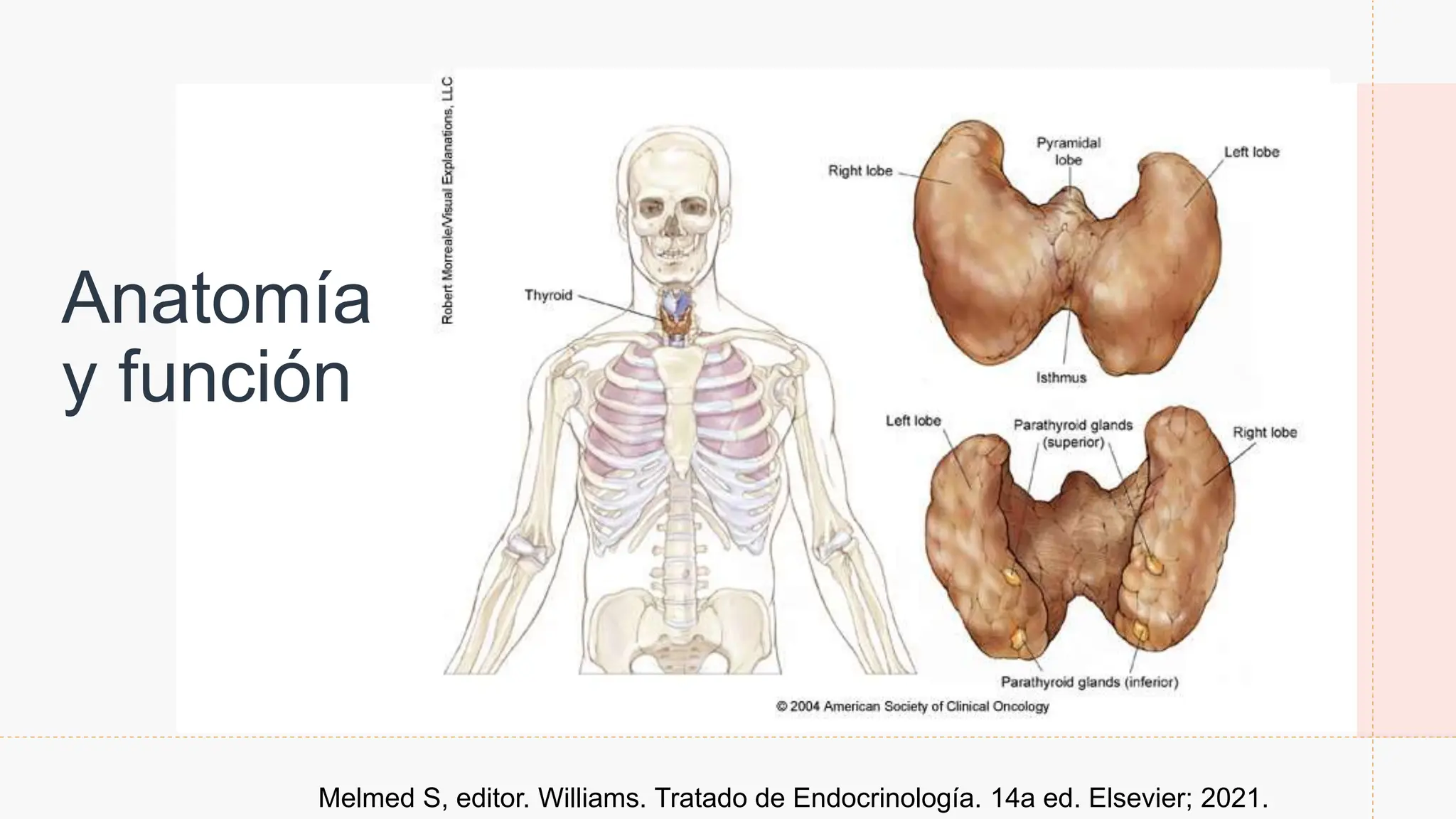 NEOPLASIAS MALIGNAS DE TIROIDES terminado.pptx