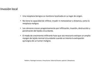 Neoplasias | PPTX