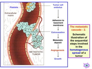 Neoplasia, two | PPT