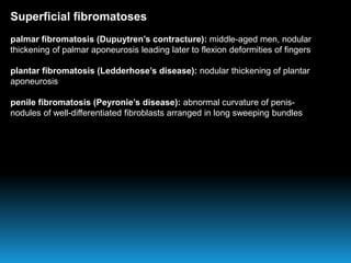 Soft Tissue Tumors | PPTX