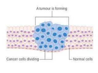 Neoplasma.pptx