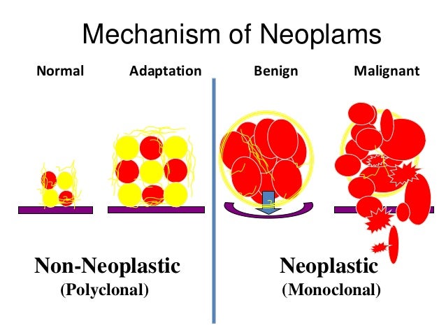 Neoplasma 1