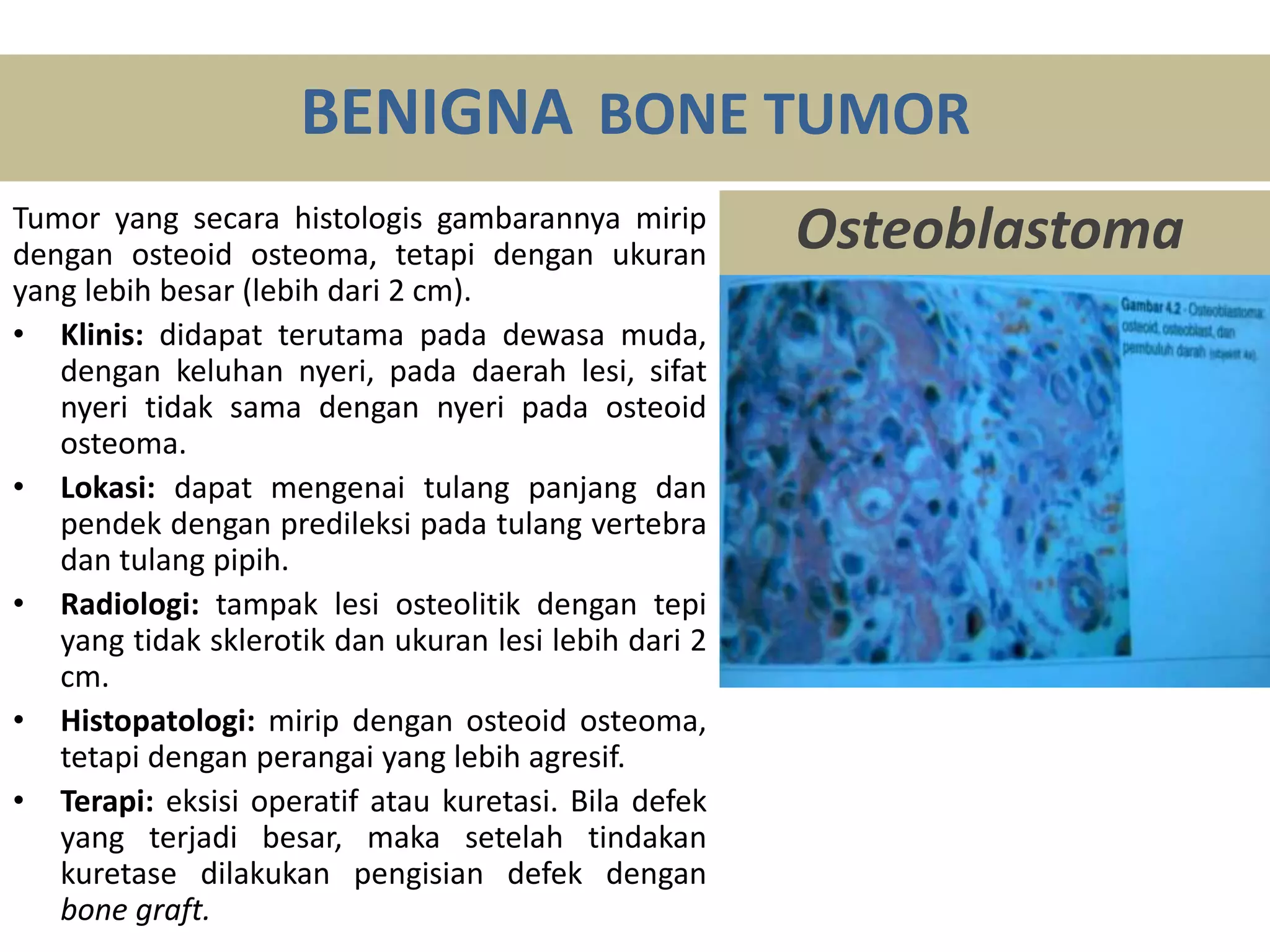 Tumor Tulang (Bone Neoplasma) | PPTX