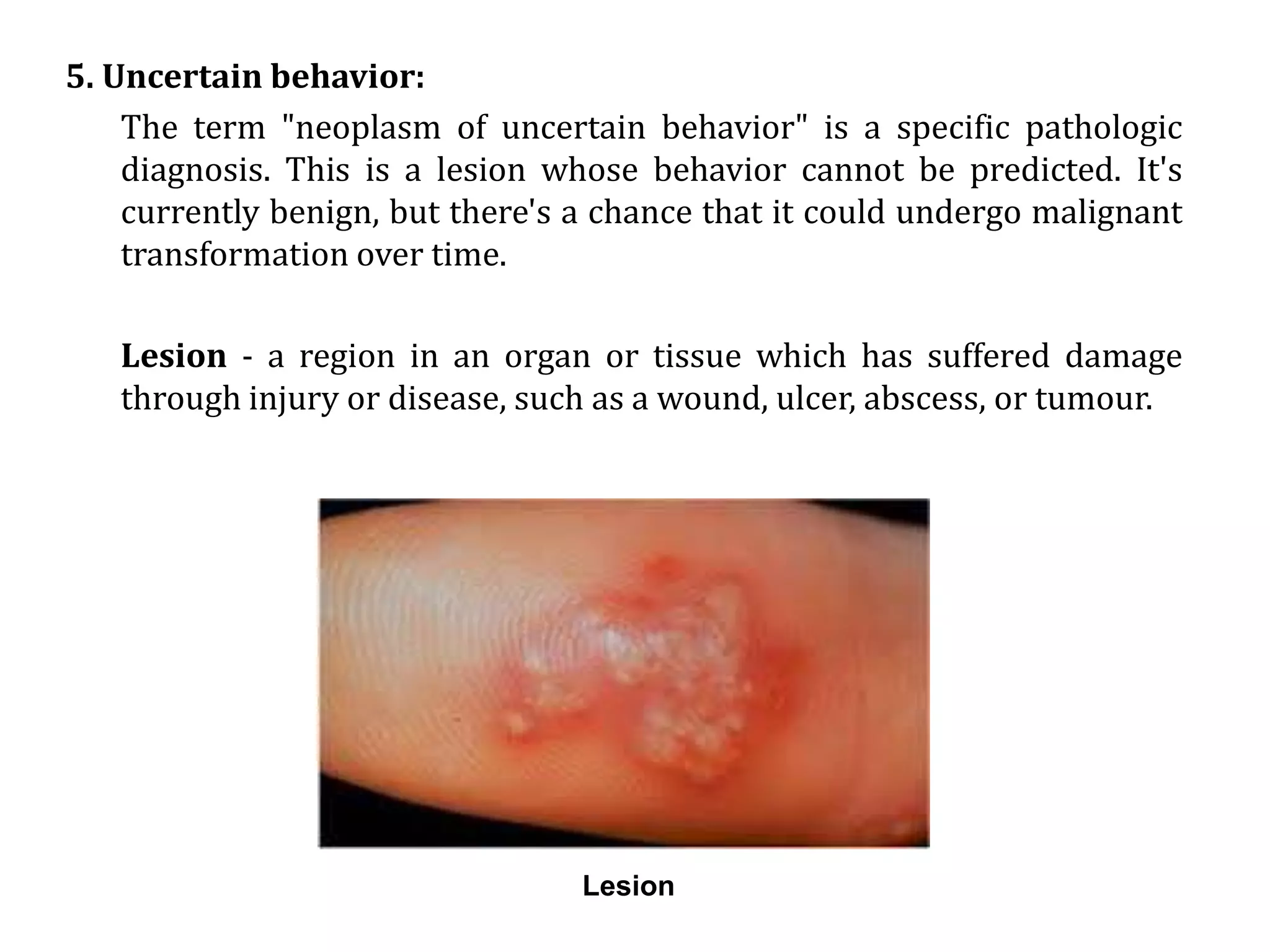 Neoplasm icd 10 guideline | PPTX