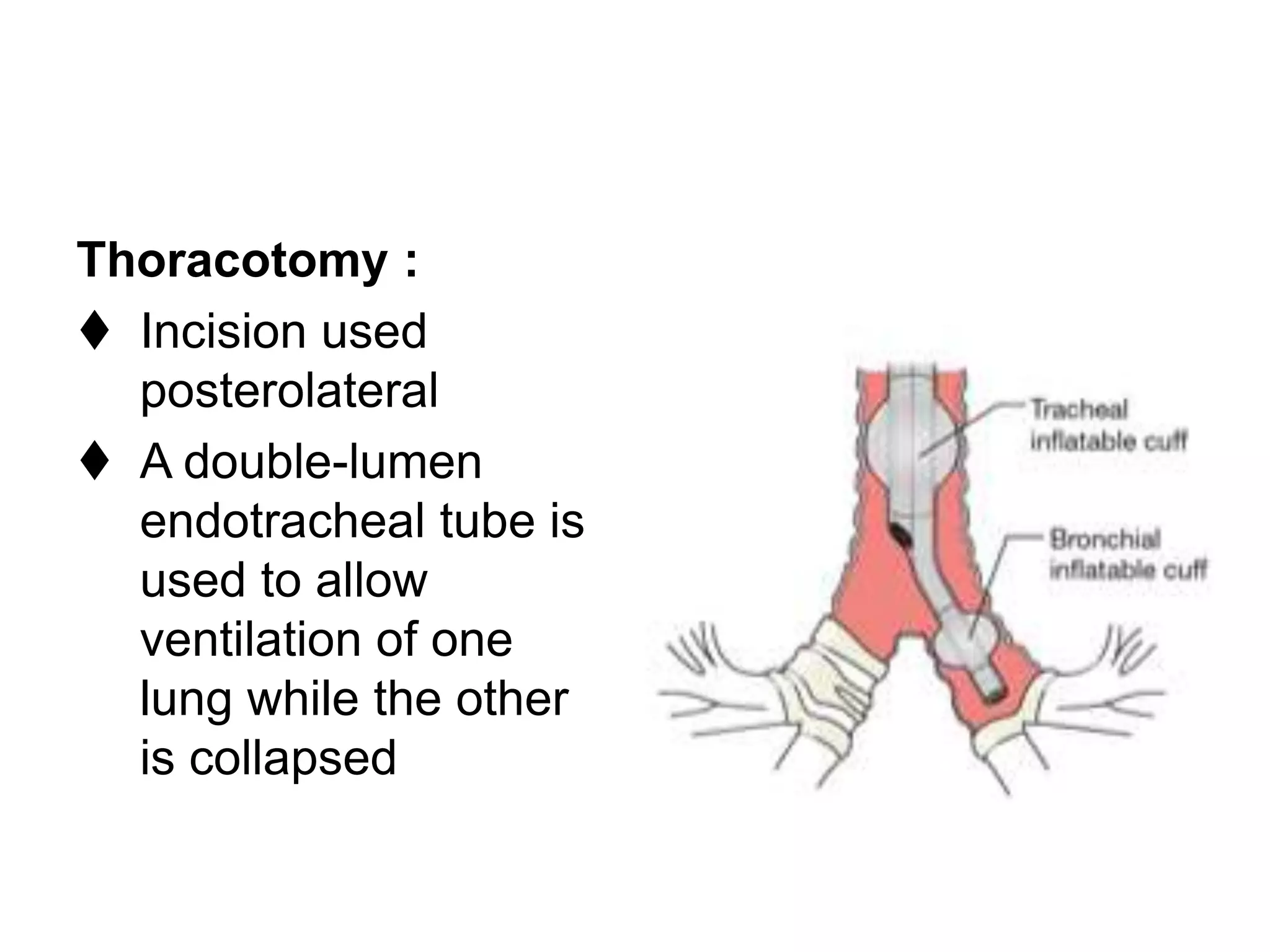 Neoplasms of Lung.pptx