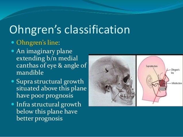 Neoplasms of nose and pns