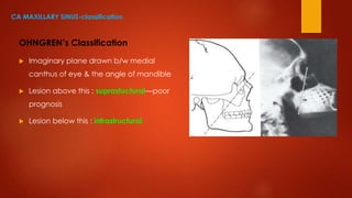 Neoplasms of paranasal sinuses.....by Navas shareef p p | PPTX
