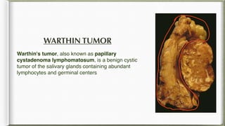 Neoplasms of Salivary Glands | PDF