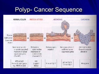 Neoplastic Colonic Polyp | PPT
