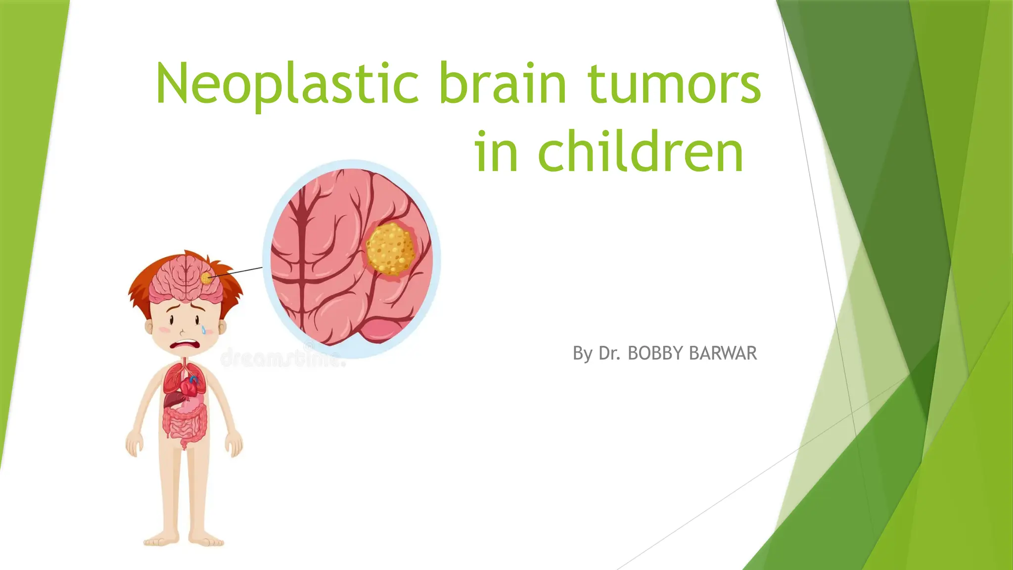 Neoplastic brain tumors in children.pptx