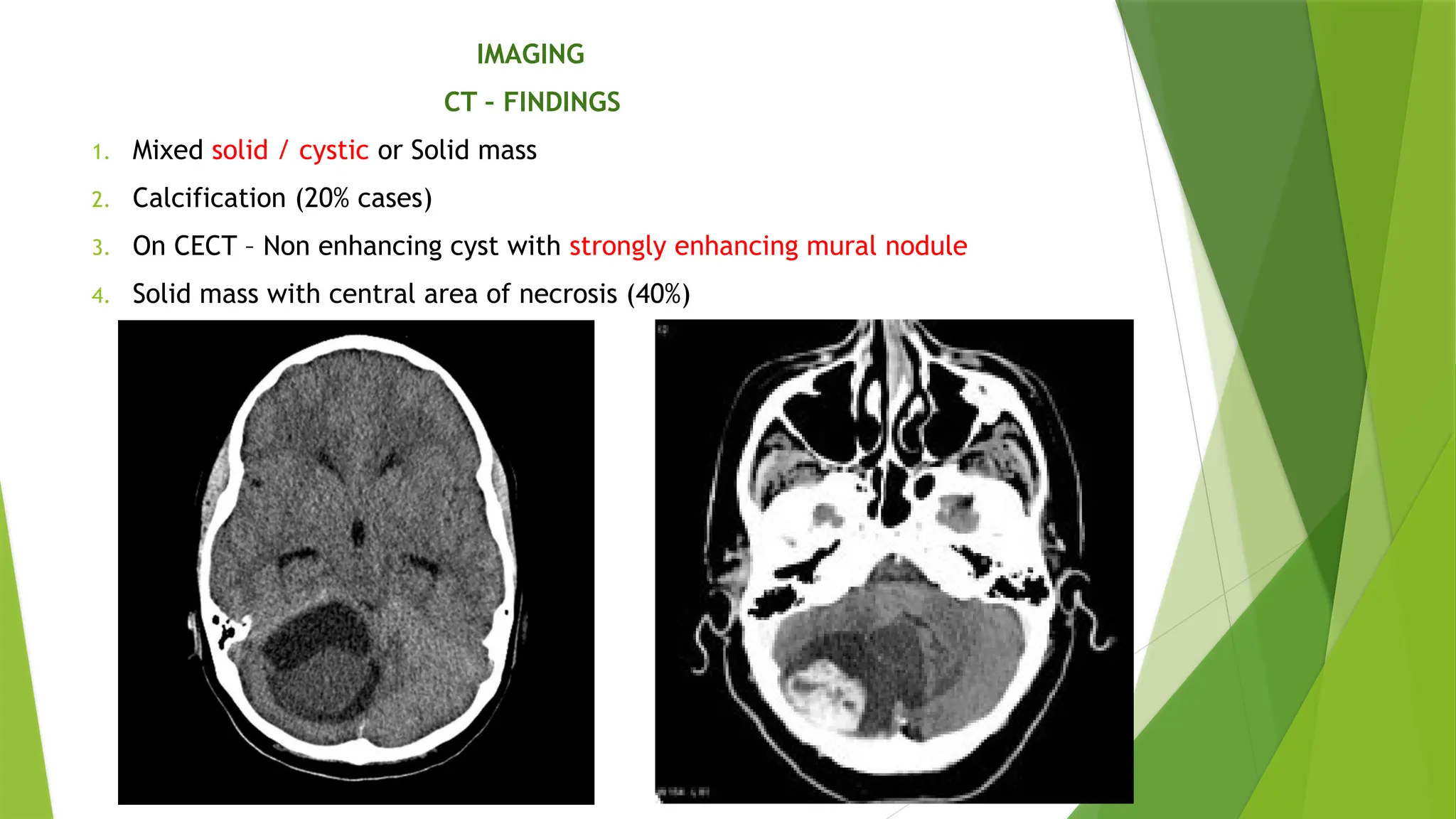 Neoplastic brain tumors in children.pptx