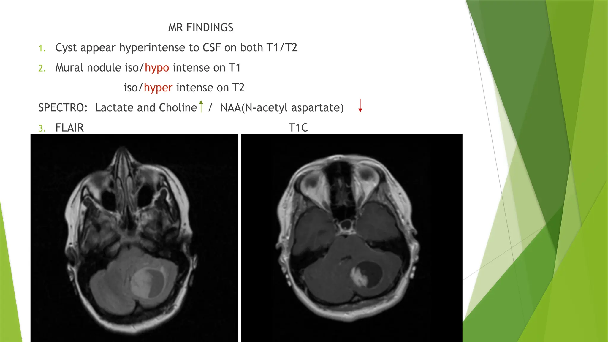 Neoplastic brain tumors in children.pptx