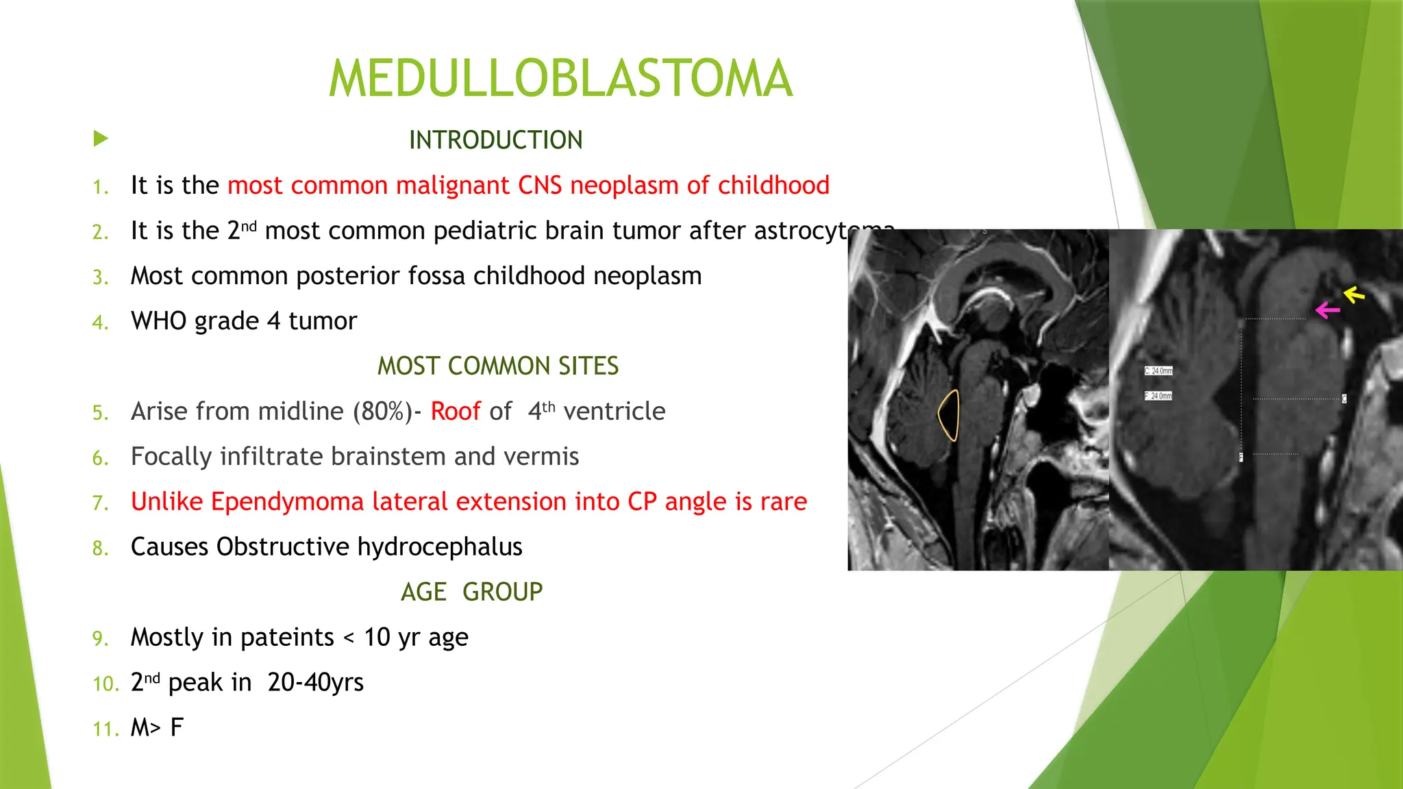 Neoplastic brain tumors in children.pptx