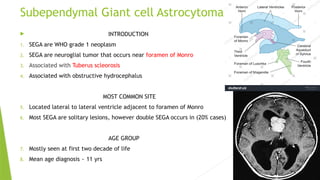 Neoplastic brain tumors in children.pptx