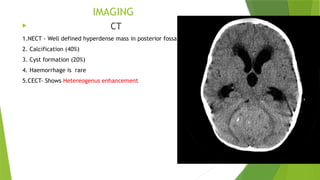 Neoplastic brain tumors in children.pptx